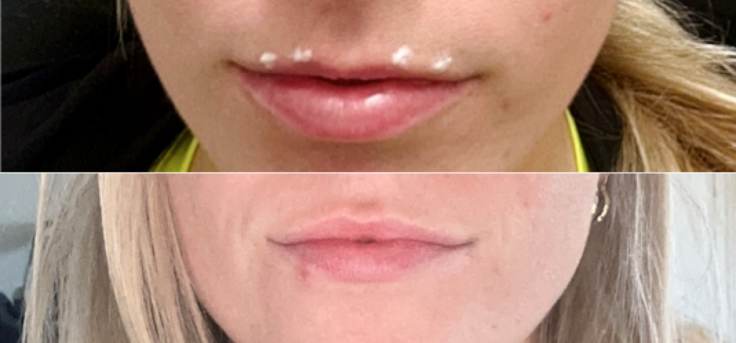 BOTOX Lansdowne | BOTOX Cosmetic Leesburg, VA | Virginia Eye